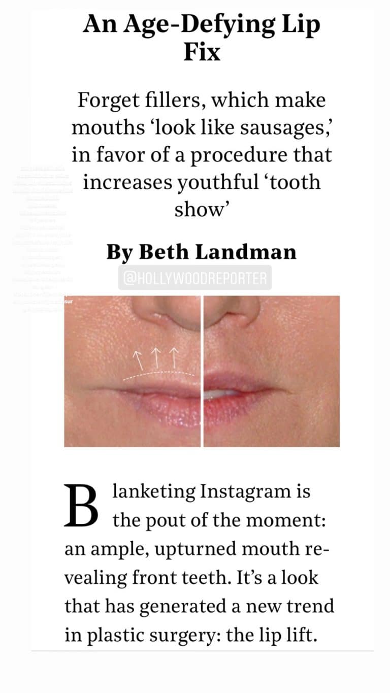 The Hollywood Reporter? The upper lip lift hits mainstream | Dr. Haworth